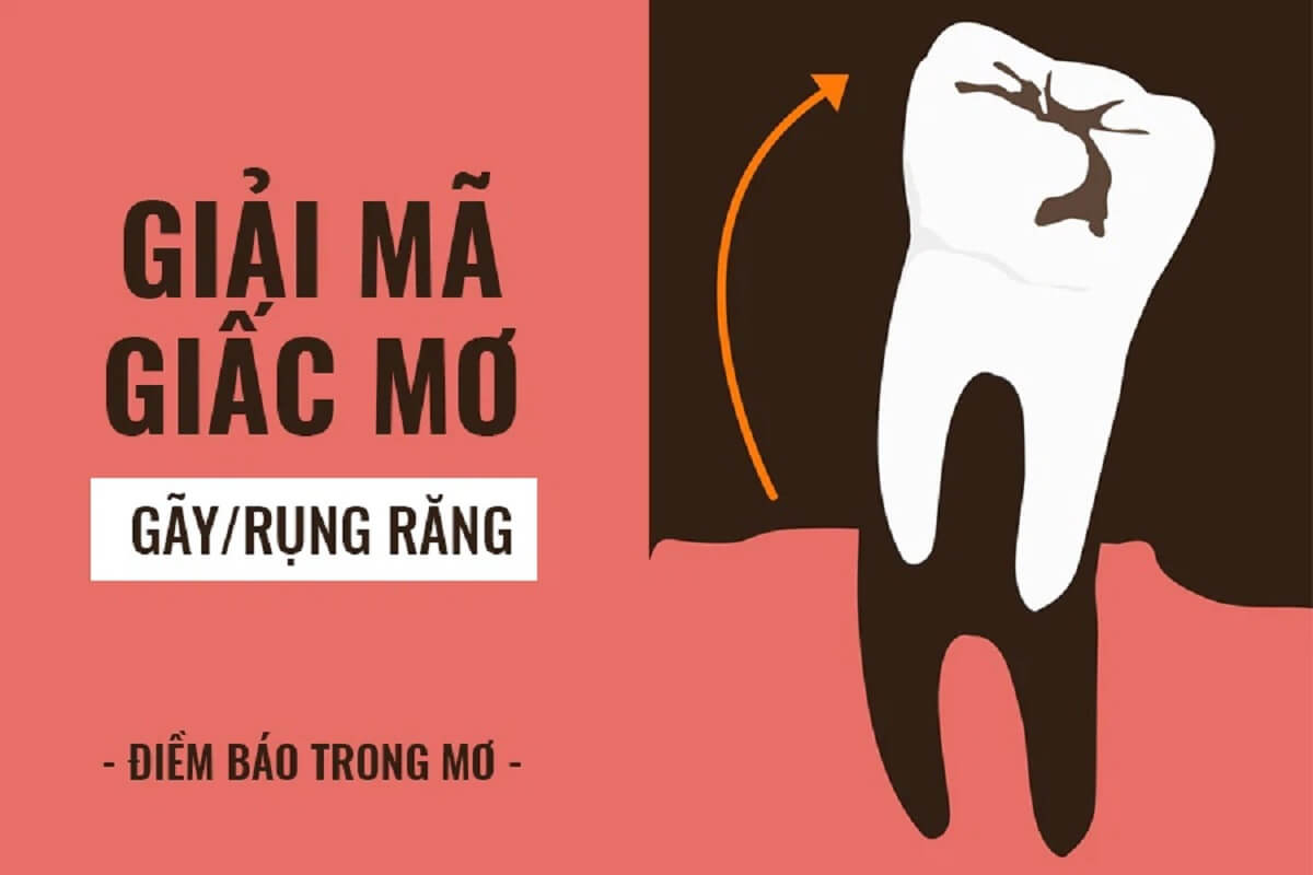 Nằm mơ thấy rụng răng điềm báo gì? Ý nghĩa liên quan đến giấc mơ
